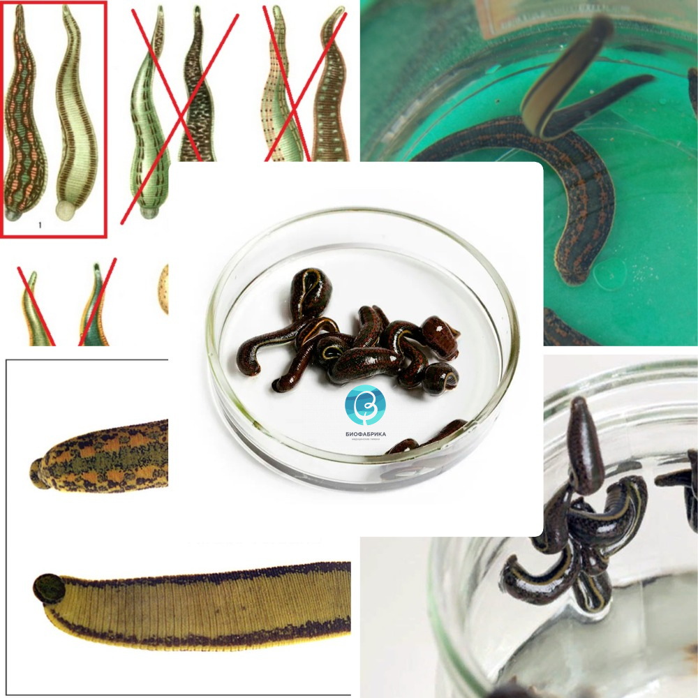 Купить пиявки